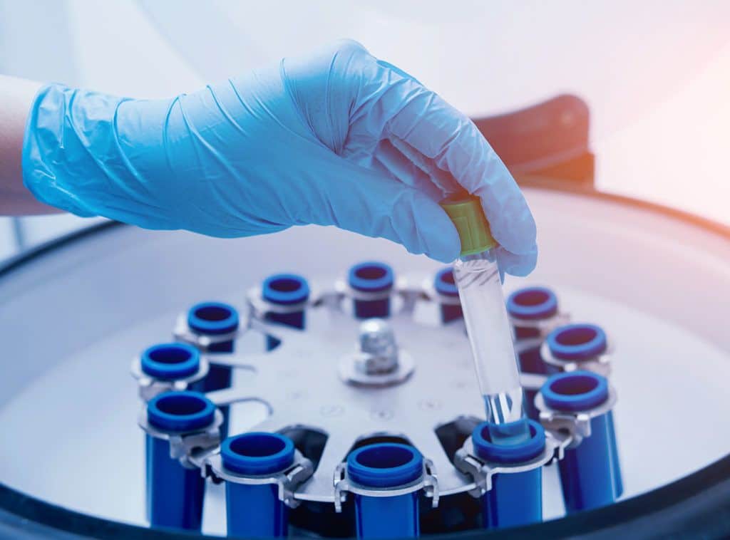 Platelet-Rich Plasma Injections in Geneva - Dr. Marianne Prevot